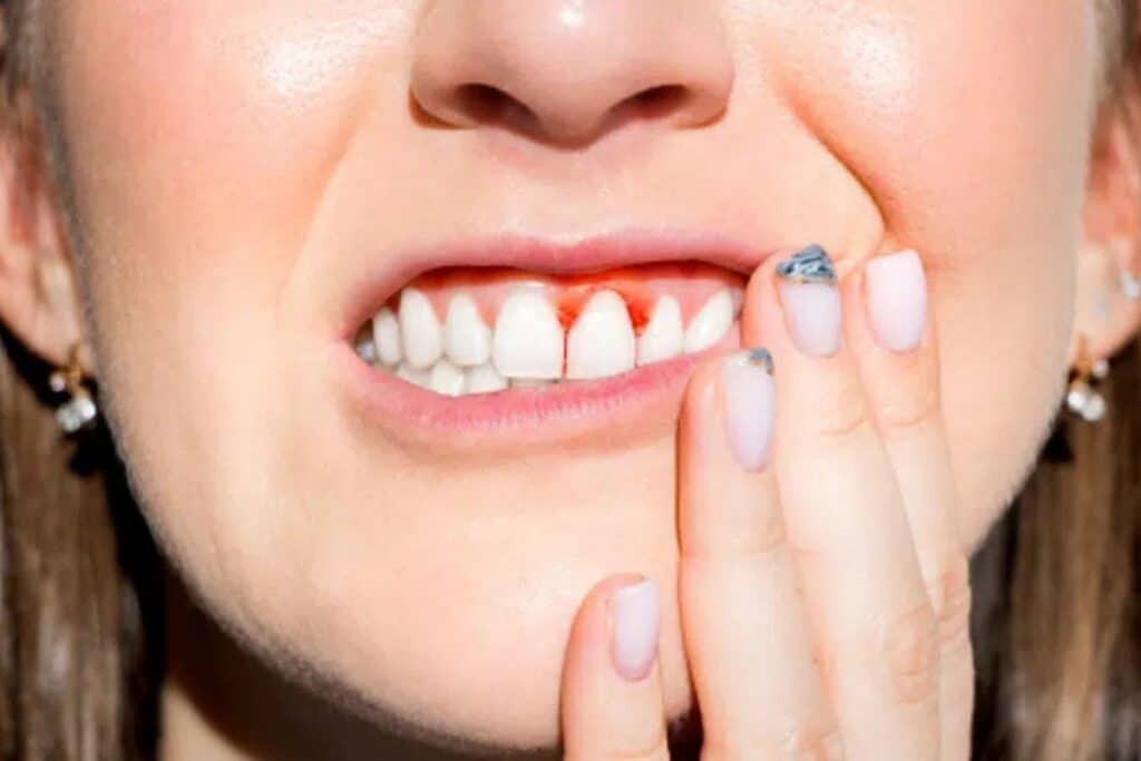 How to Fix a Misaligned Jaw Naturally: Effective Solutions for Smile